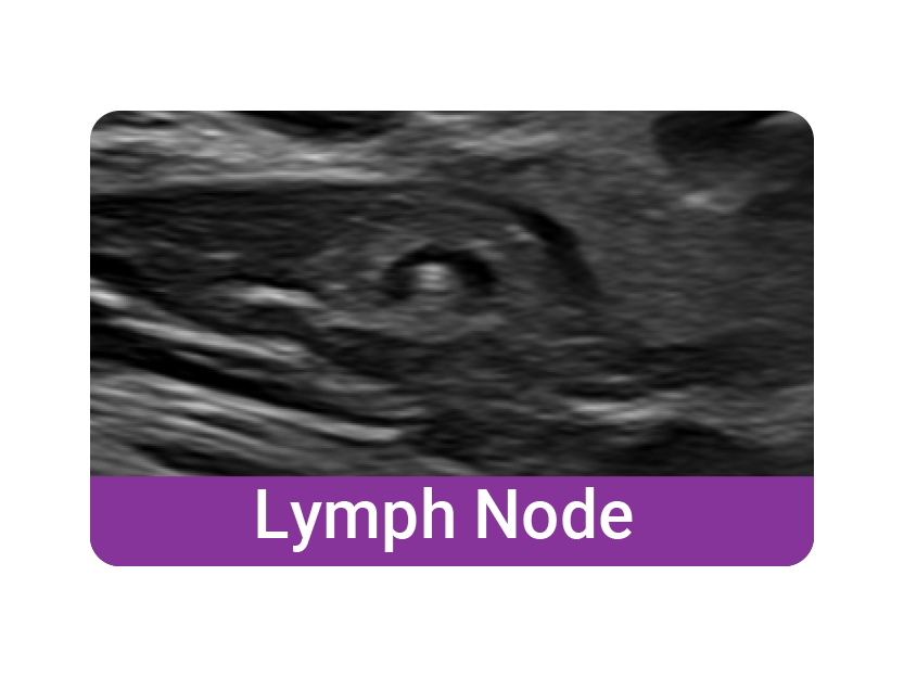 HydroMARK™ Breast Biopsy Site Marker